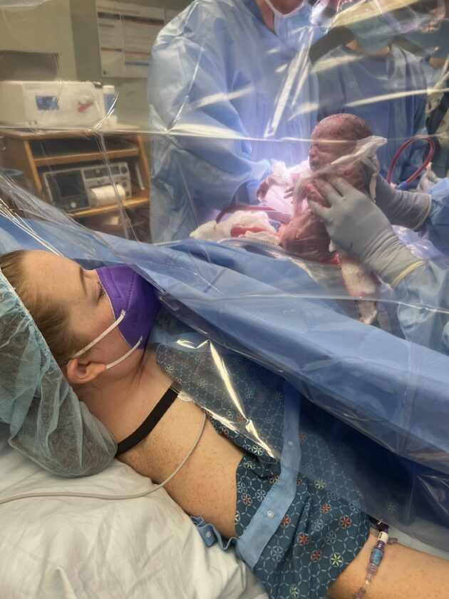 After complicated pregnancy, Lawrence mom gives birth to rare ‘MoMo ...